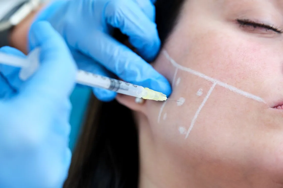 Masseter Botox - Oktay Tuney Clinic Hair Transplant, Medical Aesthetics ...
